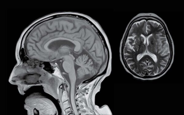 Neurology Diagnostic Imaging | Restorative Imaging Institute