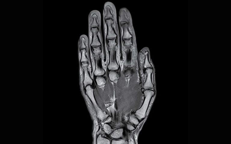 Orthopedic Diagnostic Imaging | Restorative Imaging Institute