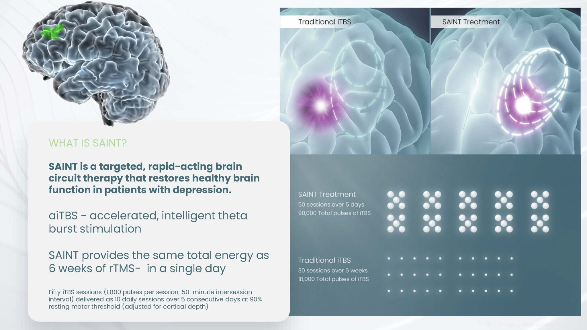 fMRI Guided TMS with SAINT® | Restorative Imaging Institute