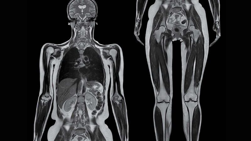 Diagnostic Imaging Services in Kansas City | Restorative Imaging Institute